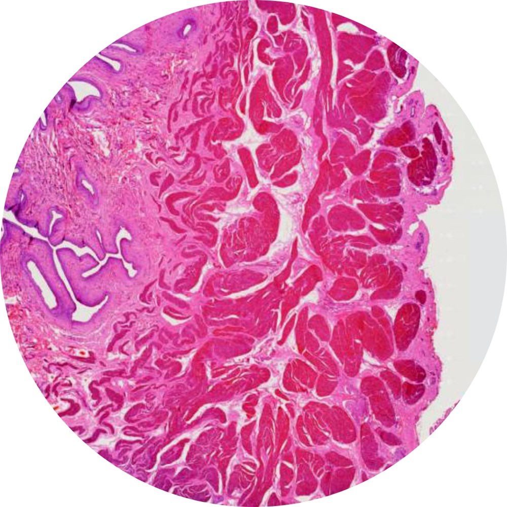 Control Slides, H&E - Human Bladder | | Rankin Biomedical