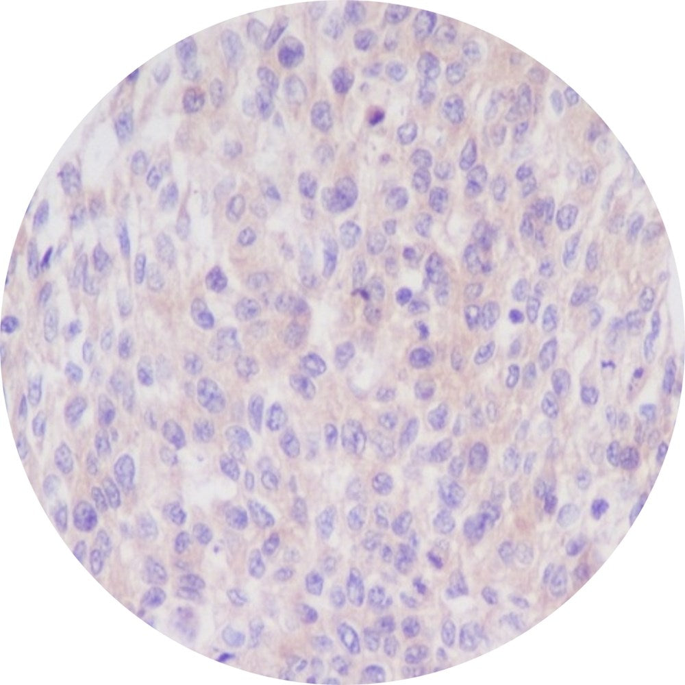 Control Slides, IHC - BIM | | Rankin Biomedical