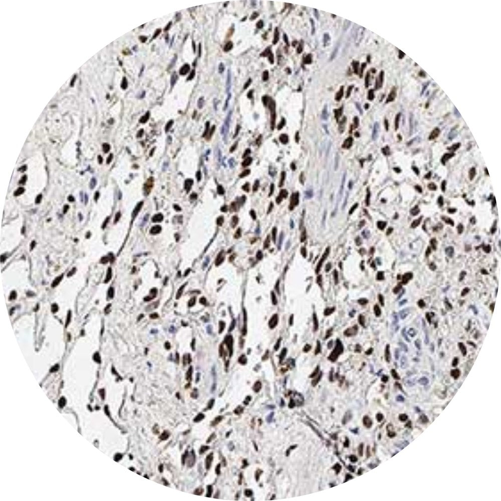 Control Slides, IHC - HHV8 | | Rankin Biomedical