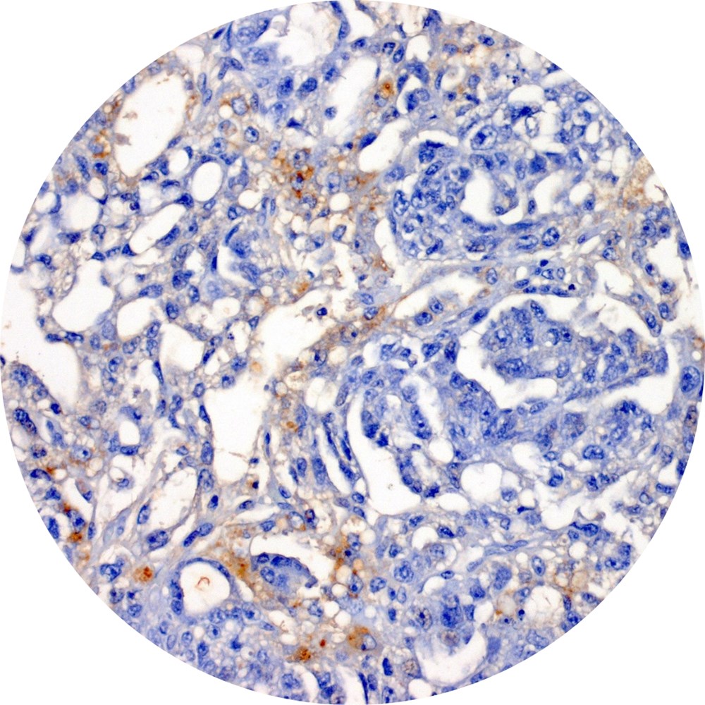 Control Slides, IHC - AFP | | Rankin Biomedical