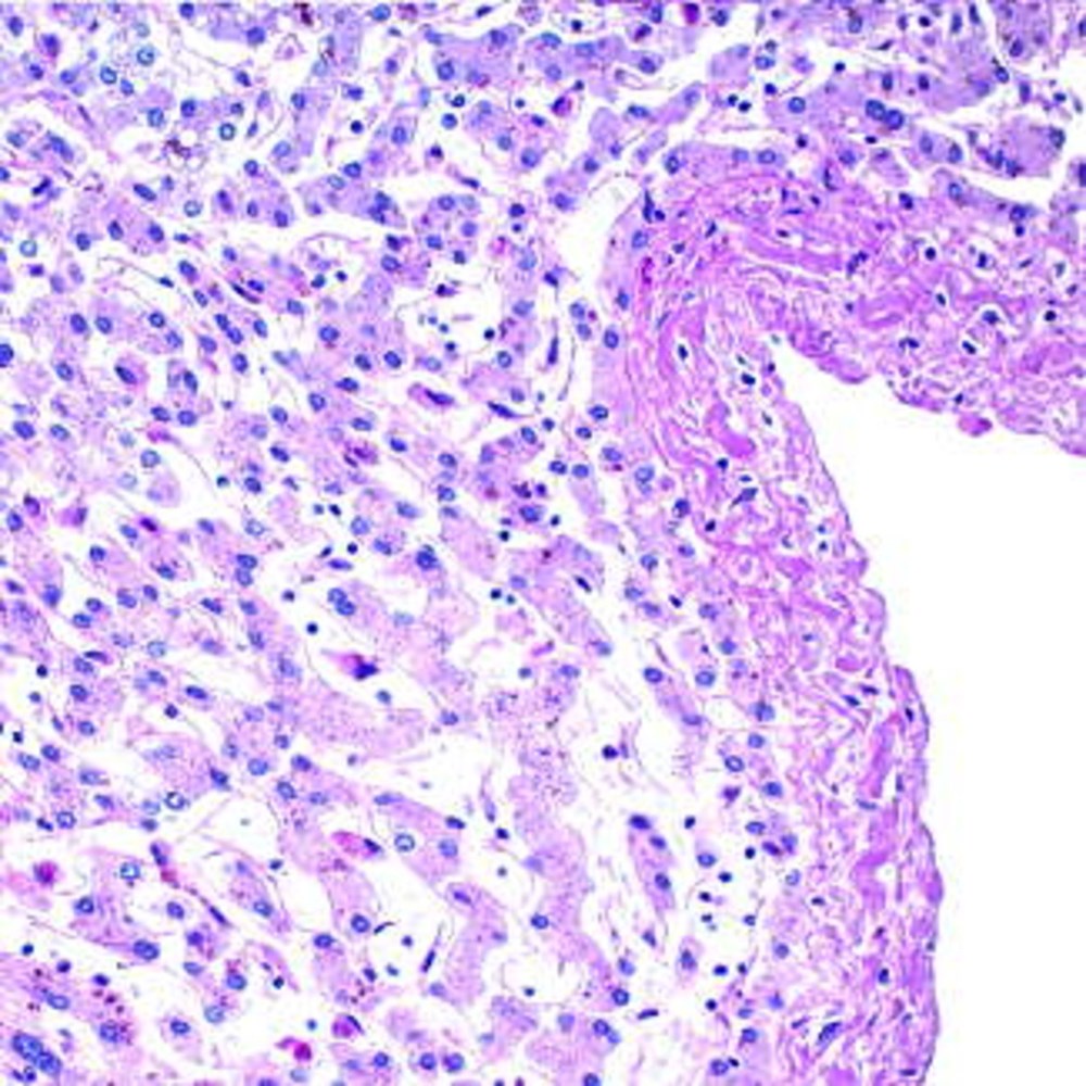 PAS Stain Kit (Diastase), Volume Optimized | | Rankin Biomedical